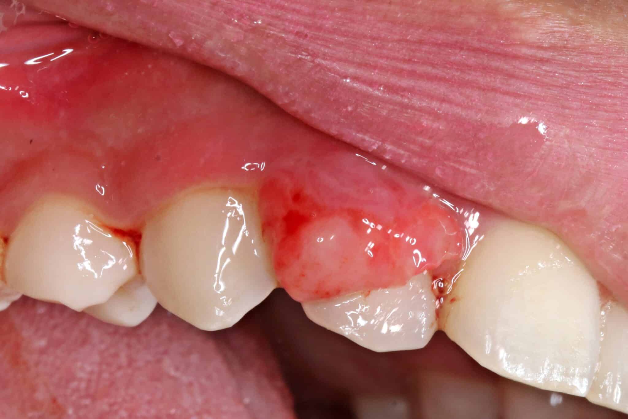 Oral Pathology - Leading Edge Dental